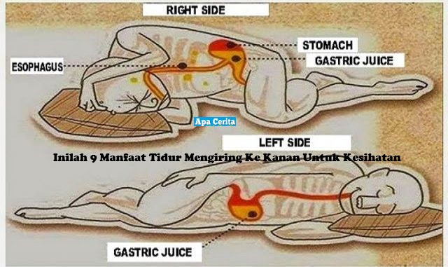 INILAH 9 MANFAAT TIDUR MENGIRING KE KANAN UNTUK KESIHATAN INILAH 9 MANFAAT TIDUR MENGIRING KE KANAN UNTUK KESIHATAN